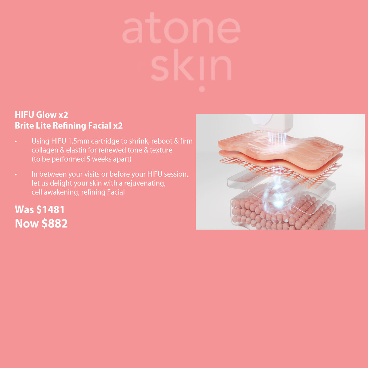 Firm & Glow Package: HIFU Glow and Brite Lite Refining Facial x2 ...